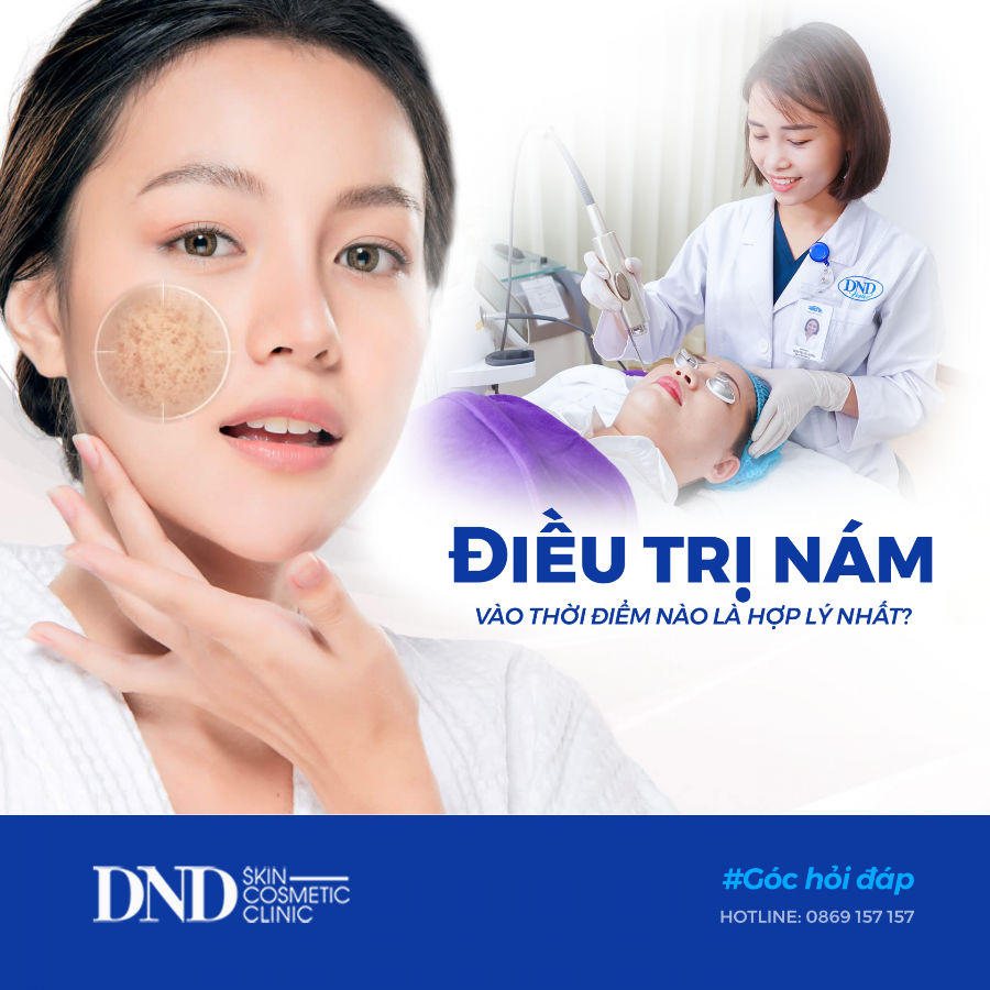 Đâu là thời điểm vàng điều trị nám tốt nhất trong năm? – Thẩm mỹ Quốc ...